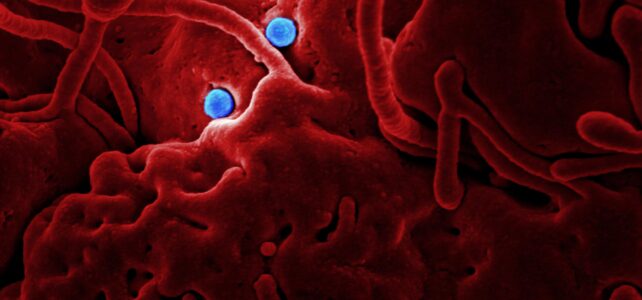 Ebola Book: The Hot Zone Explains an Epidemic - Shortform Books