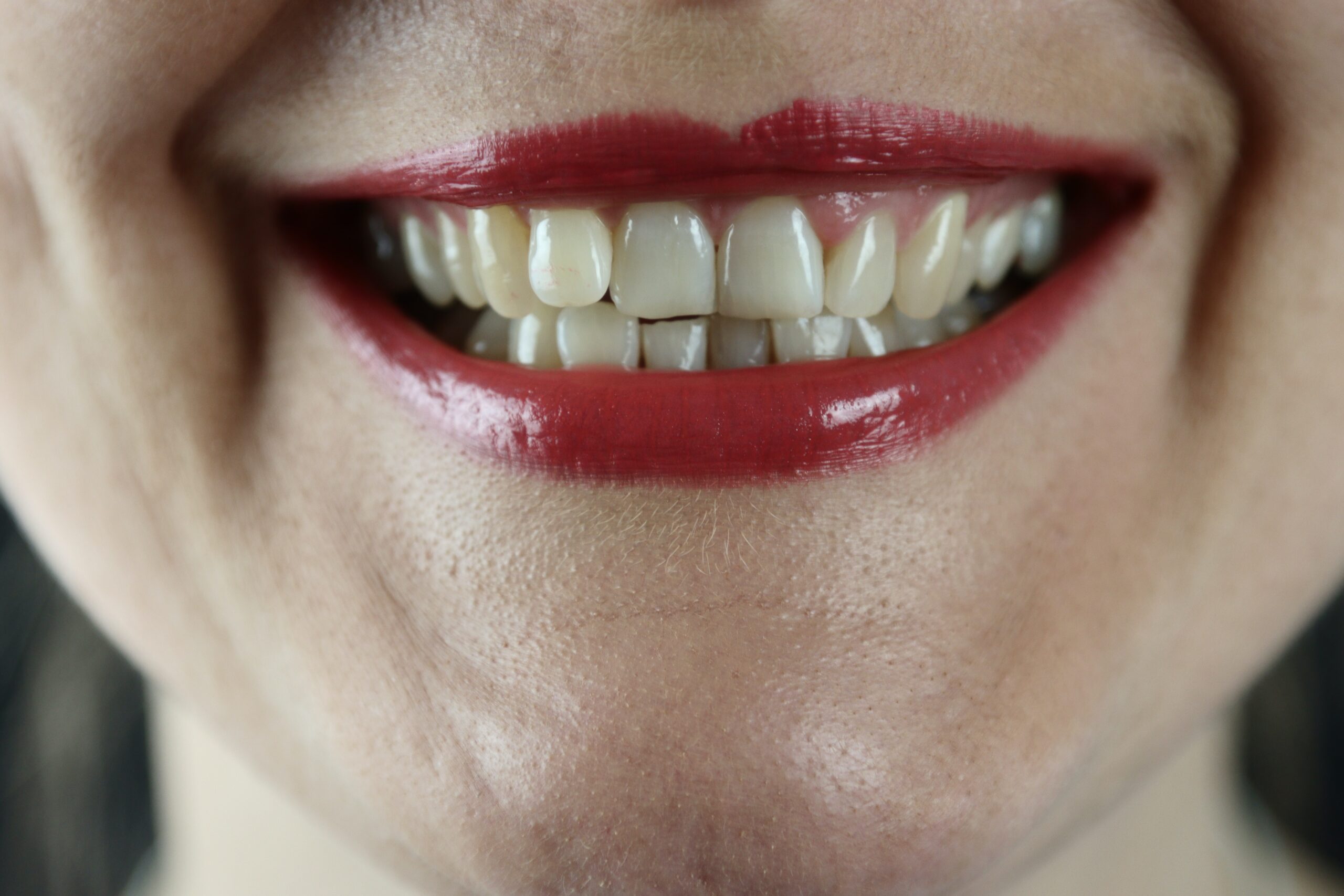 Why Do Humans Have Teeth? Evolution Can Tell Us | Shortform Books