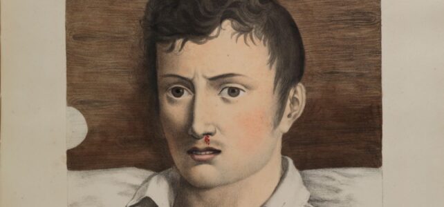 The Yellow Fever Epidemic Begins in Fever 1793 - Shortform Books