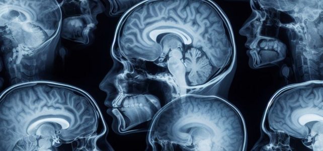 Dr. Amen: SPECT Imaging Beats Symptom-Based Diagnosis - Shortform Books